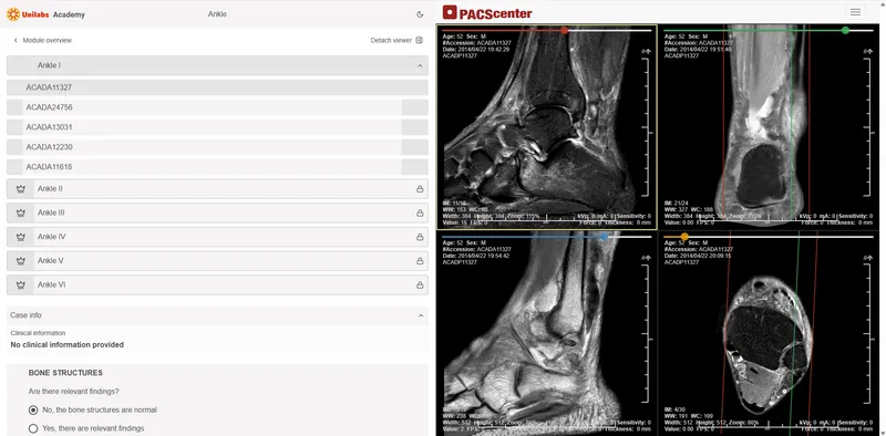 Radiology Case Reporting Simulator For Radiologists | Unilabs Academy ...